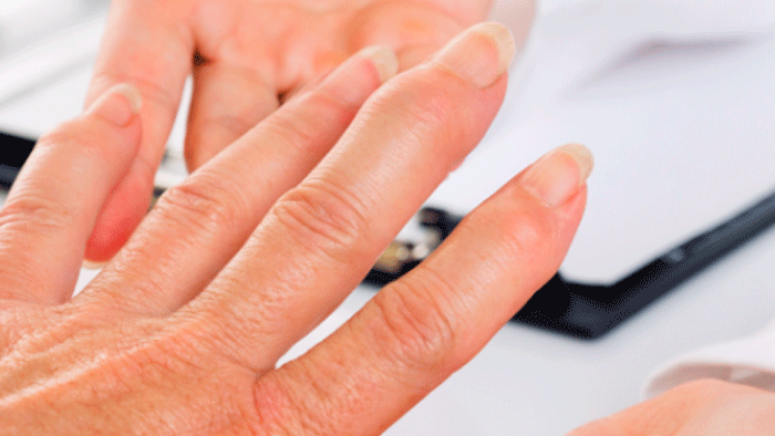 Systemic Autoimmune Rheumatic Diseases (SARDS) Diagnostics