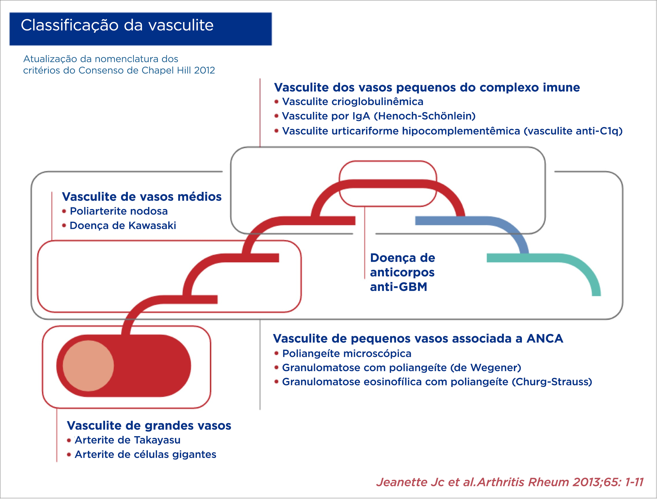 Arterite De Celulas Gigantes Arteritis De Células Gigantes, Aortitis