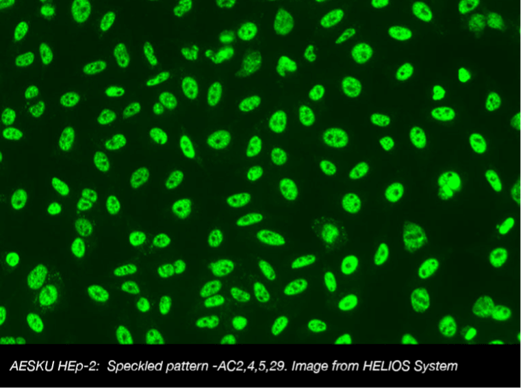 Systemic Autoimmune Rheumatic Diseases (SARDS) Diagnostics
