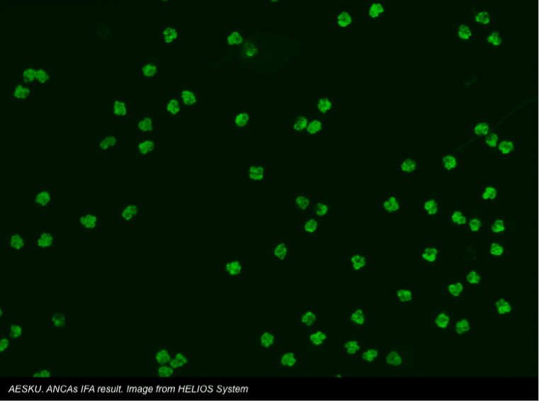 Inflammatory Bowel Disease (IBD) Diagnostics
